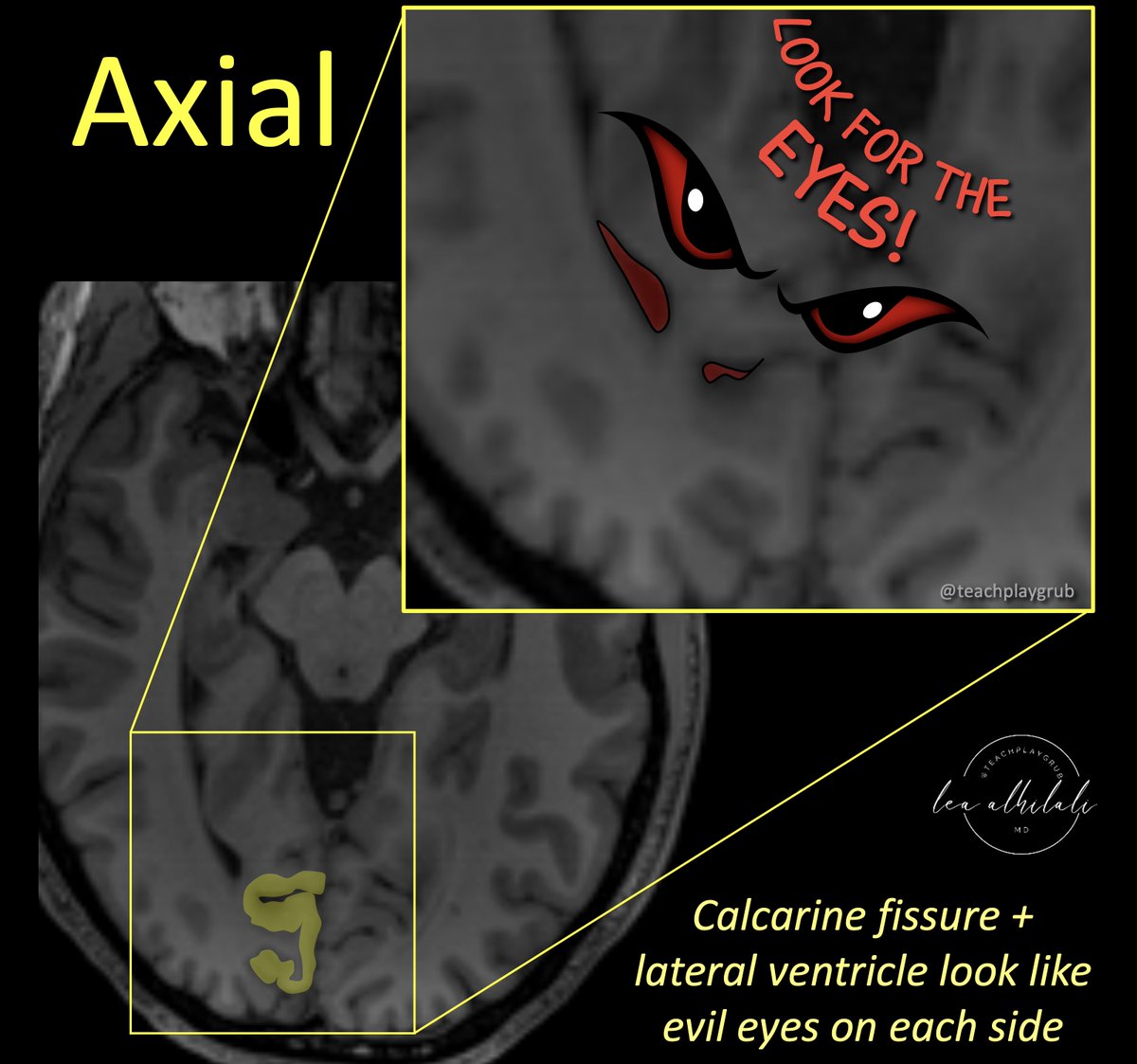 Having trouble visualizing the location of the visual cortex? Wish you ...
