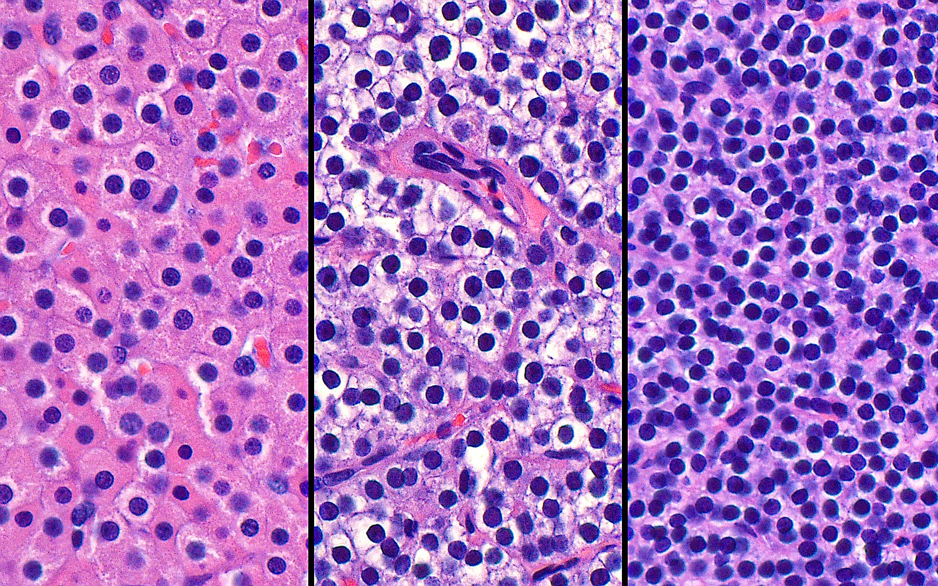 Parathyroid Histology Parathyroid Histology Parathyroid Gland