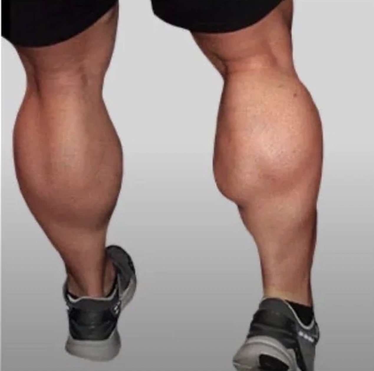 Fat Calf Muscles Effective Tips To Slim Down Your Calves