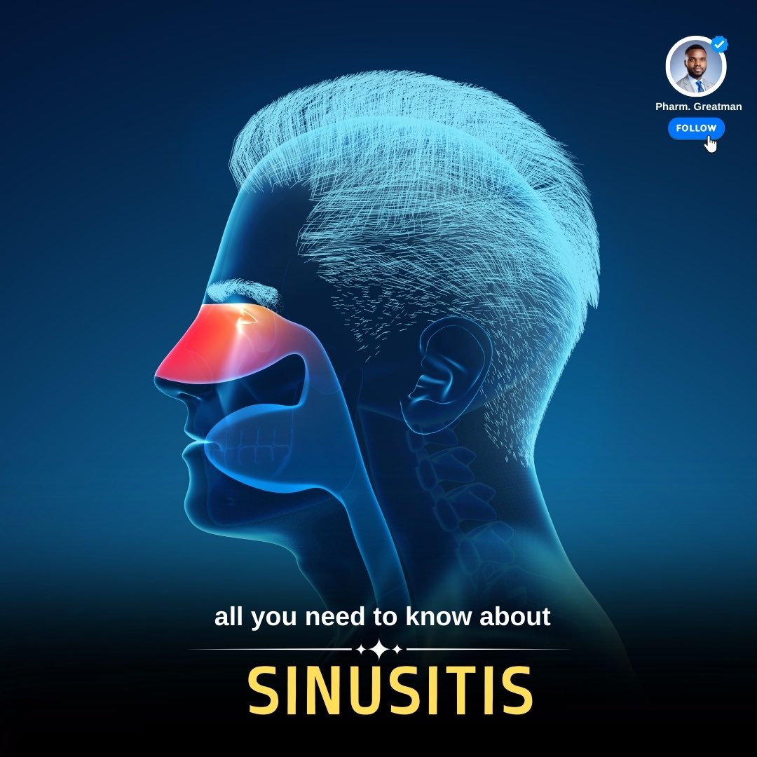 Sinusitis can cause stuffy nose and pressure in your face This is the most comprehensive thread ...