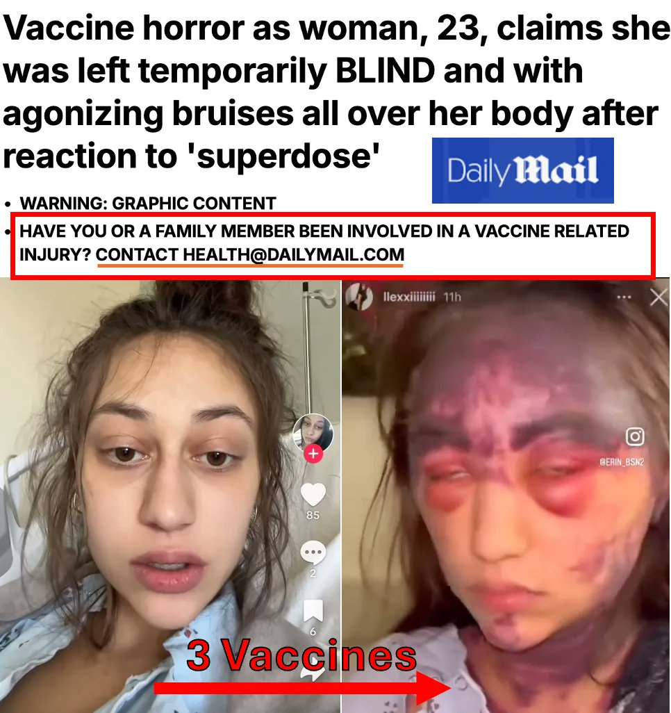 Thread by @MidwesternDoc on Thread Reader App – Thread Reader App
