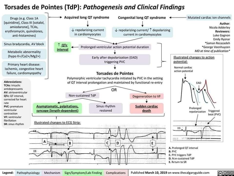 🔴Torsades de pointes (TdP) is a specific form of PVT occurring in the ...