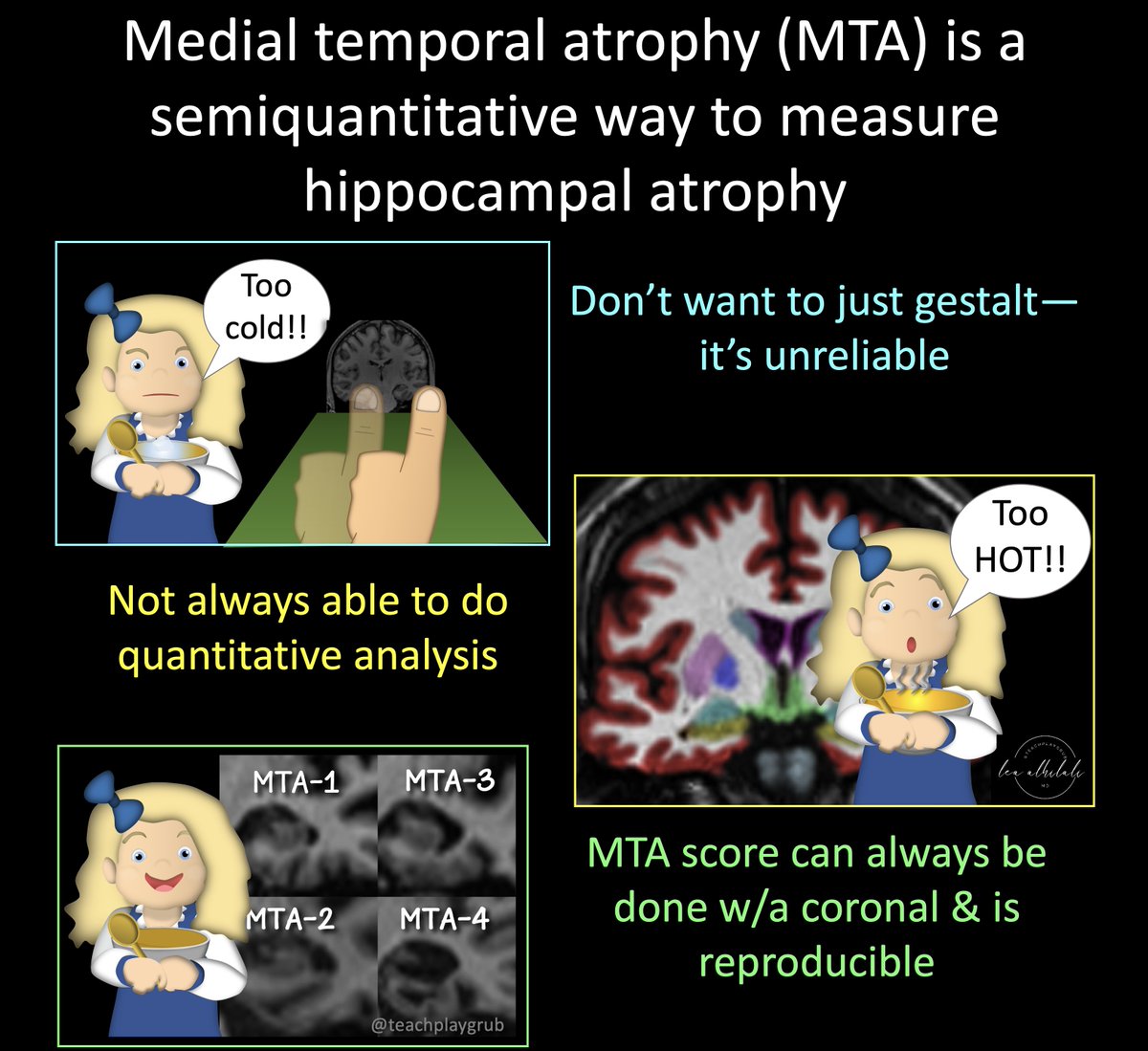 1/Having trouble remembering what to look for on scans for Alzheimer’s ...