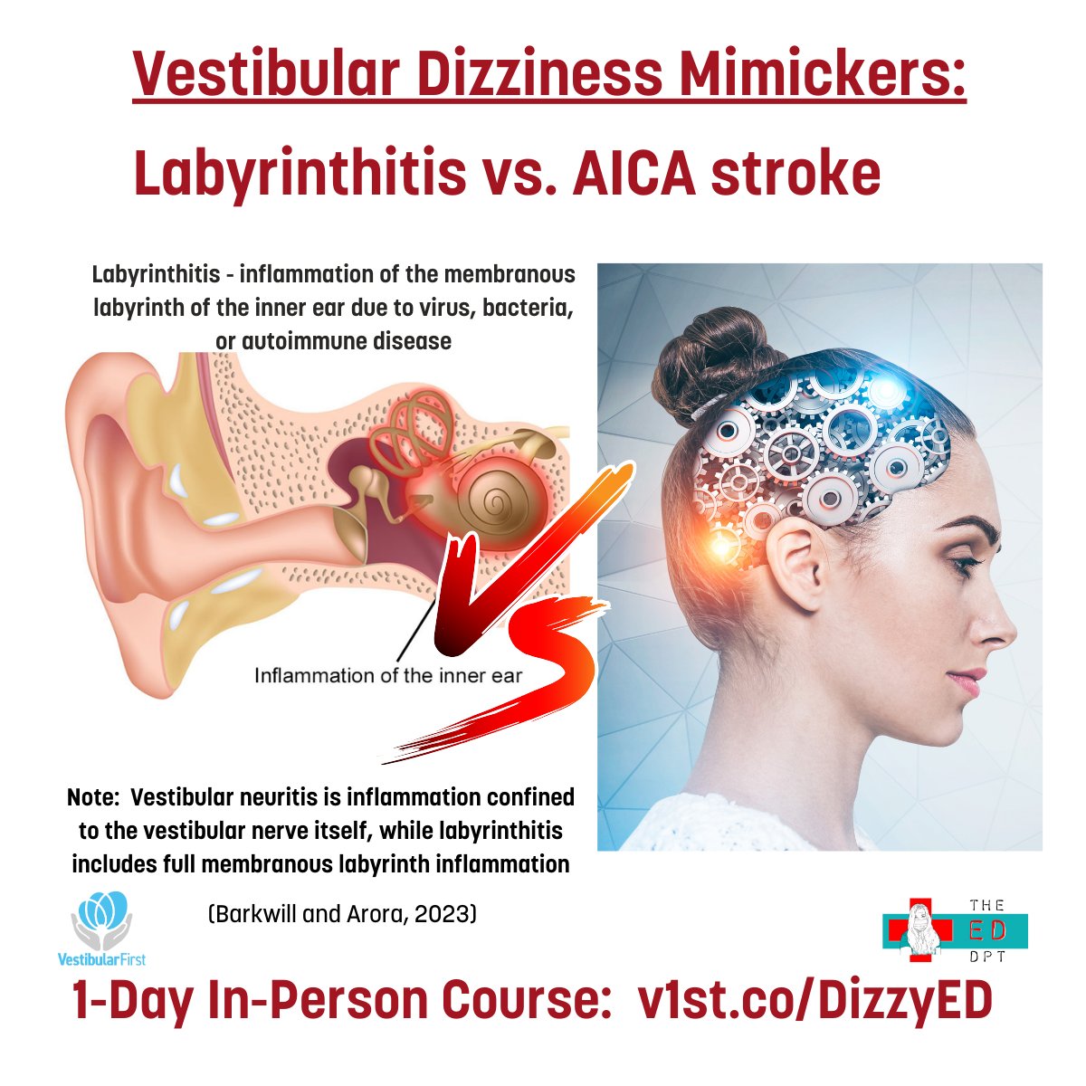 Virus Of Labyrinthitis