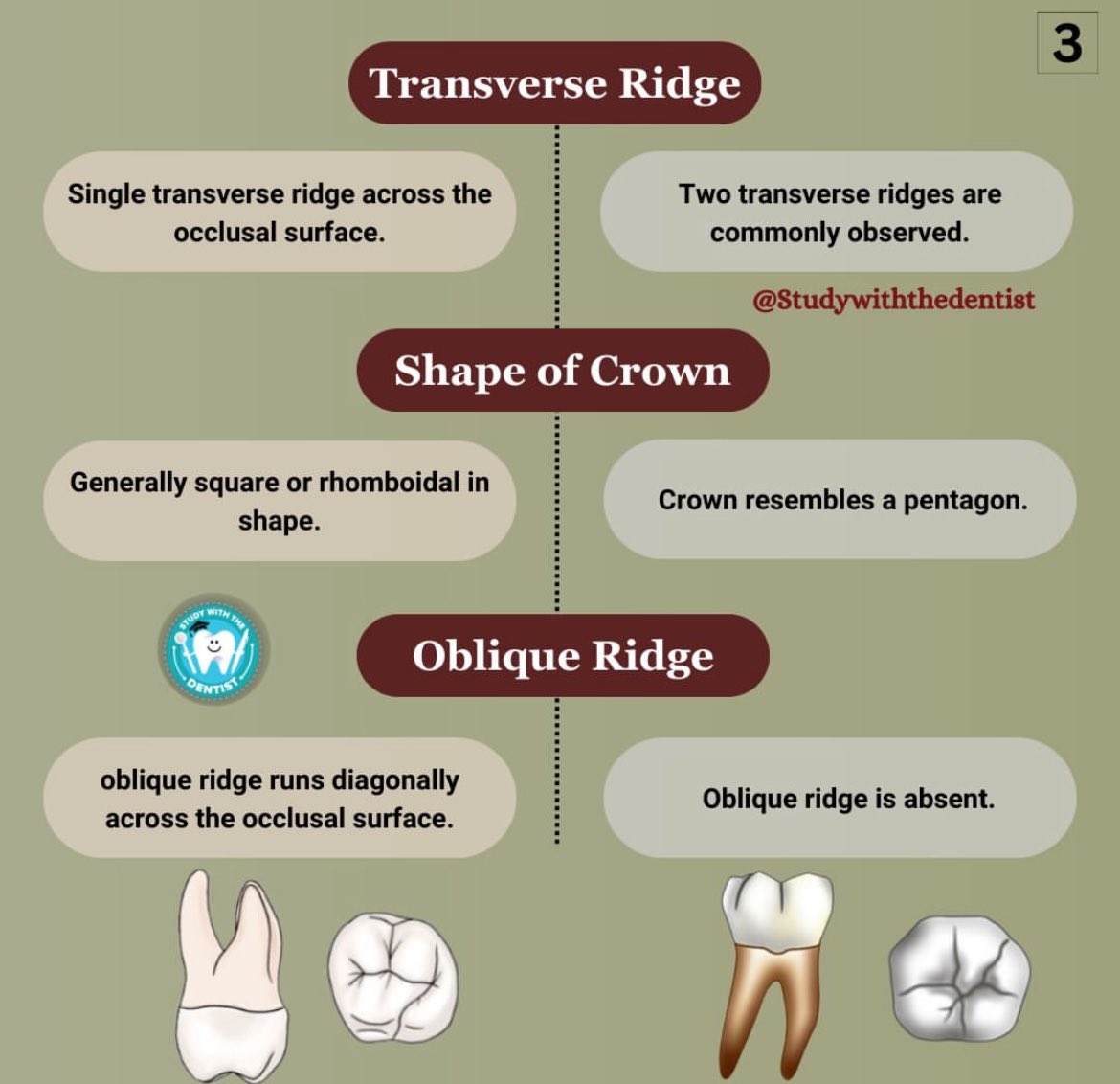 Oblique Ridge Maxillary Molars Stress Analysis On Mesiolingual Cavity