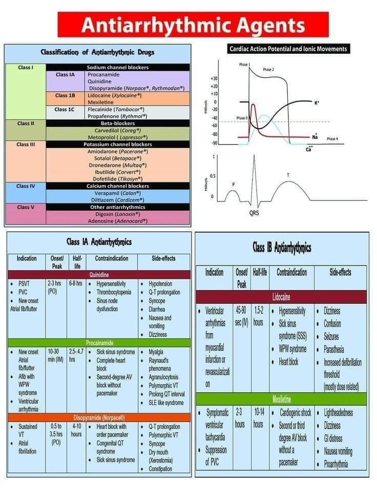 Vaughan Williams Antiarrhythmic Classification Of Meds Pharmacology