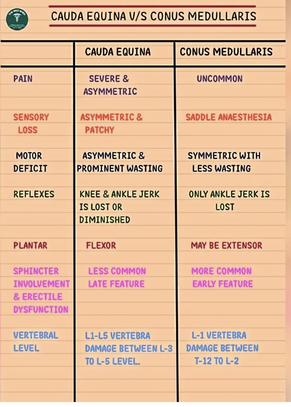 What Is The Difference Between Conus Medullaris Syndrome Conus