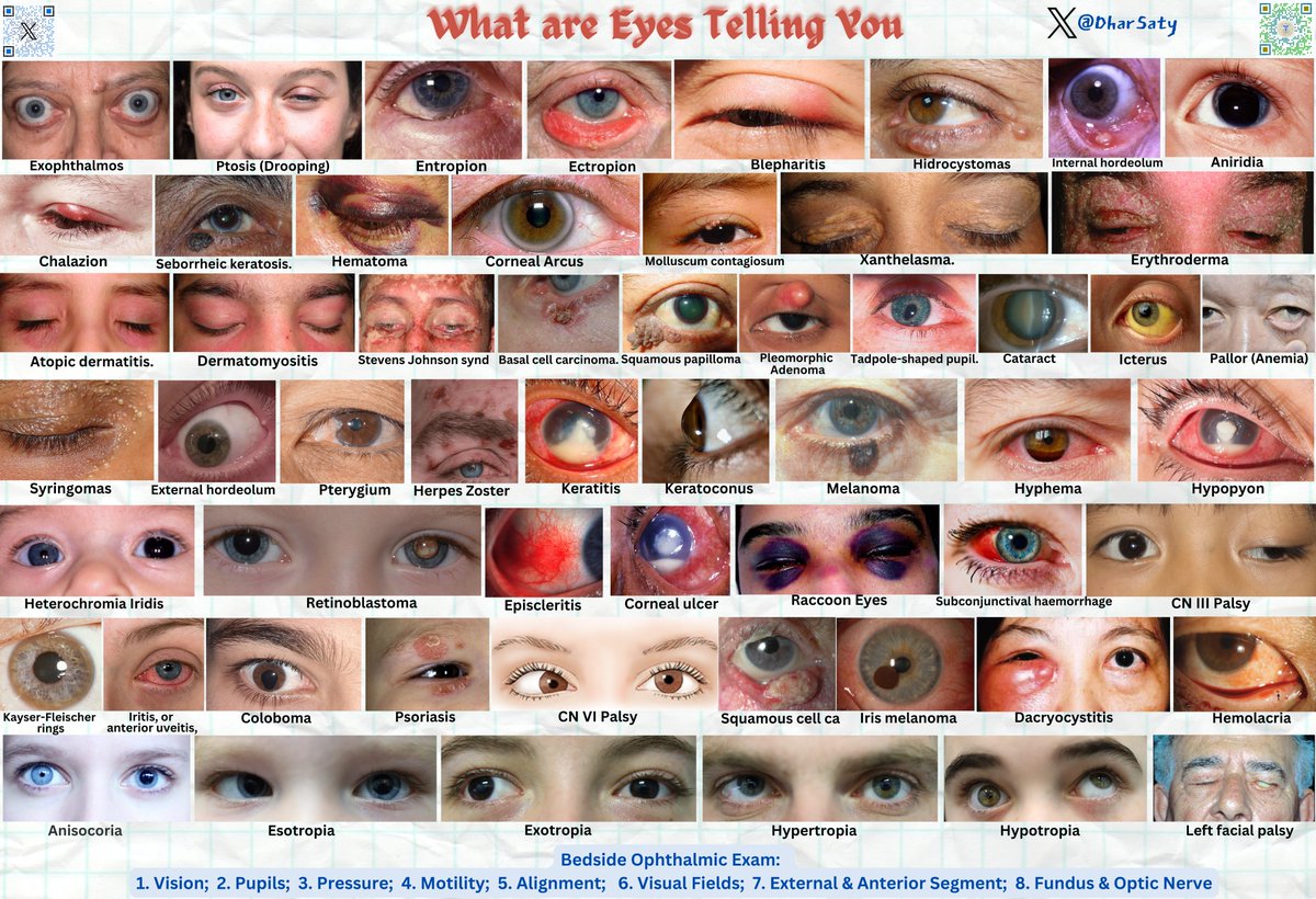 Natural Eye Colors Chart