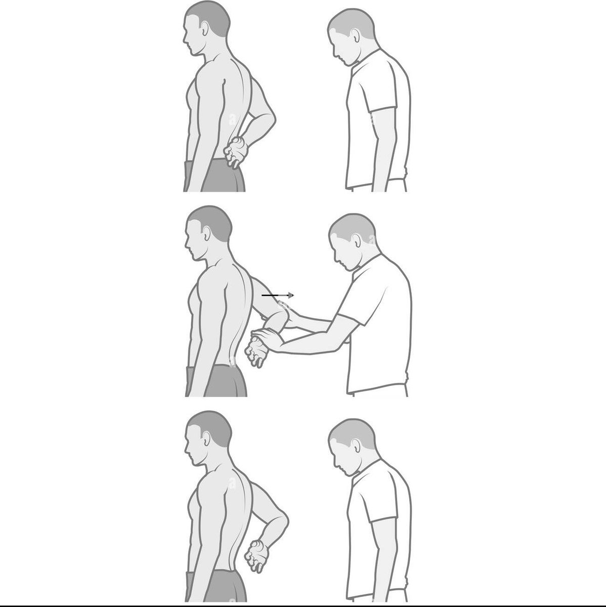 Subscapularis Muscle Strength Test