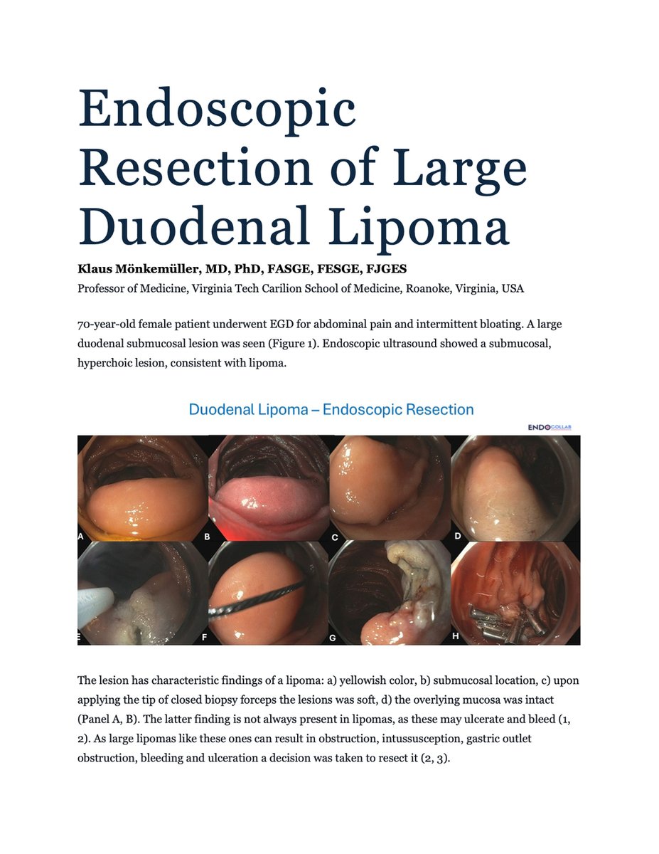 Submucosal Lesion