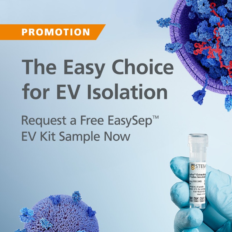 Evaluate a faster and simpler approach to extracellular vesicle (EV ...