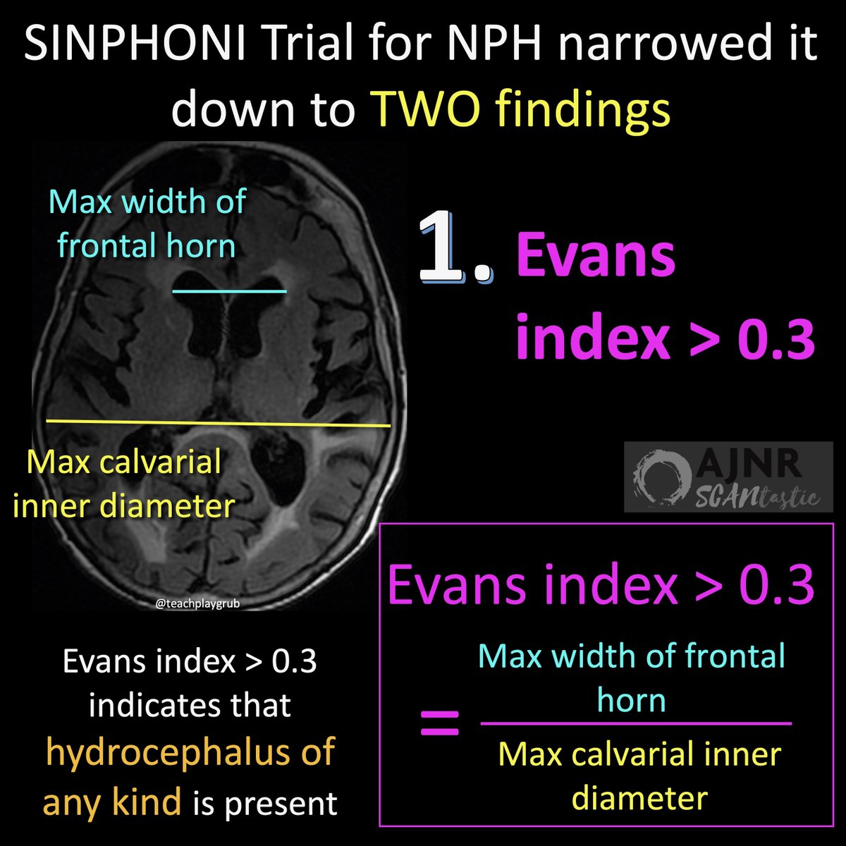 Thread by @teachplaygrub on Thread Reader App – Thread Reader App
