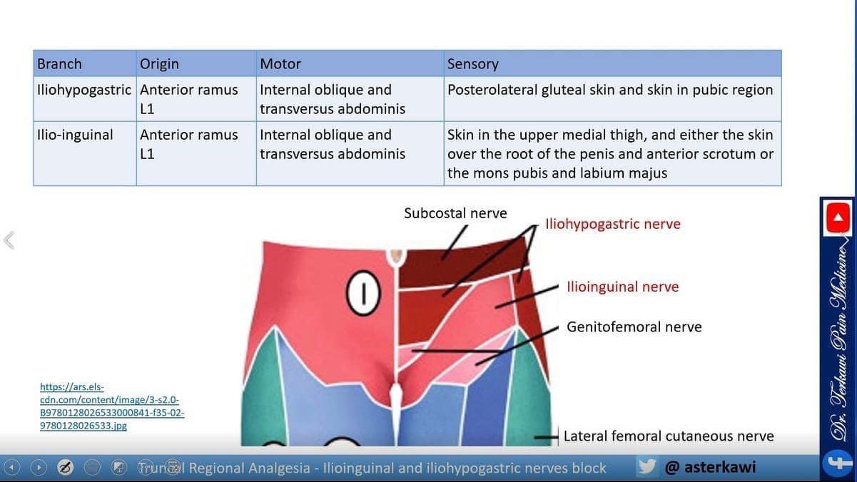 Ilioinguinal Nerve Dermatome