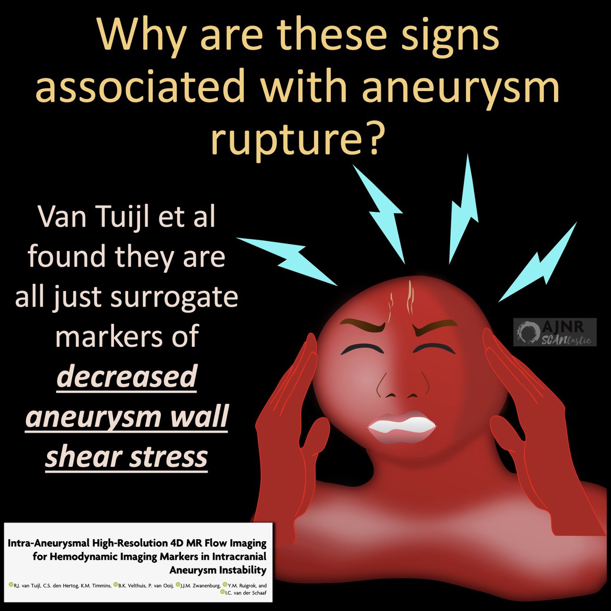 1/Time to rupture all your misconceptions about aneurysms! When you see ...