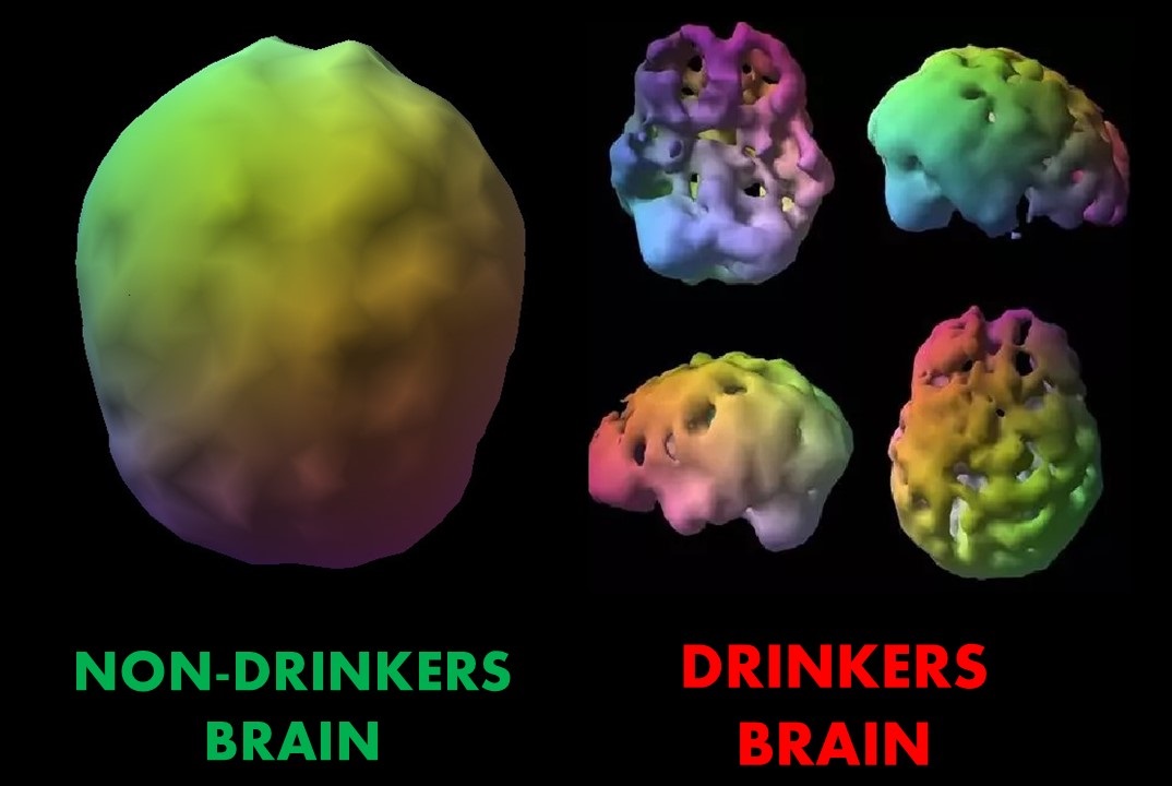 How to fix your dopamine-fried brain permanently. It all starts with these 7 simple lifestyle ...