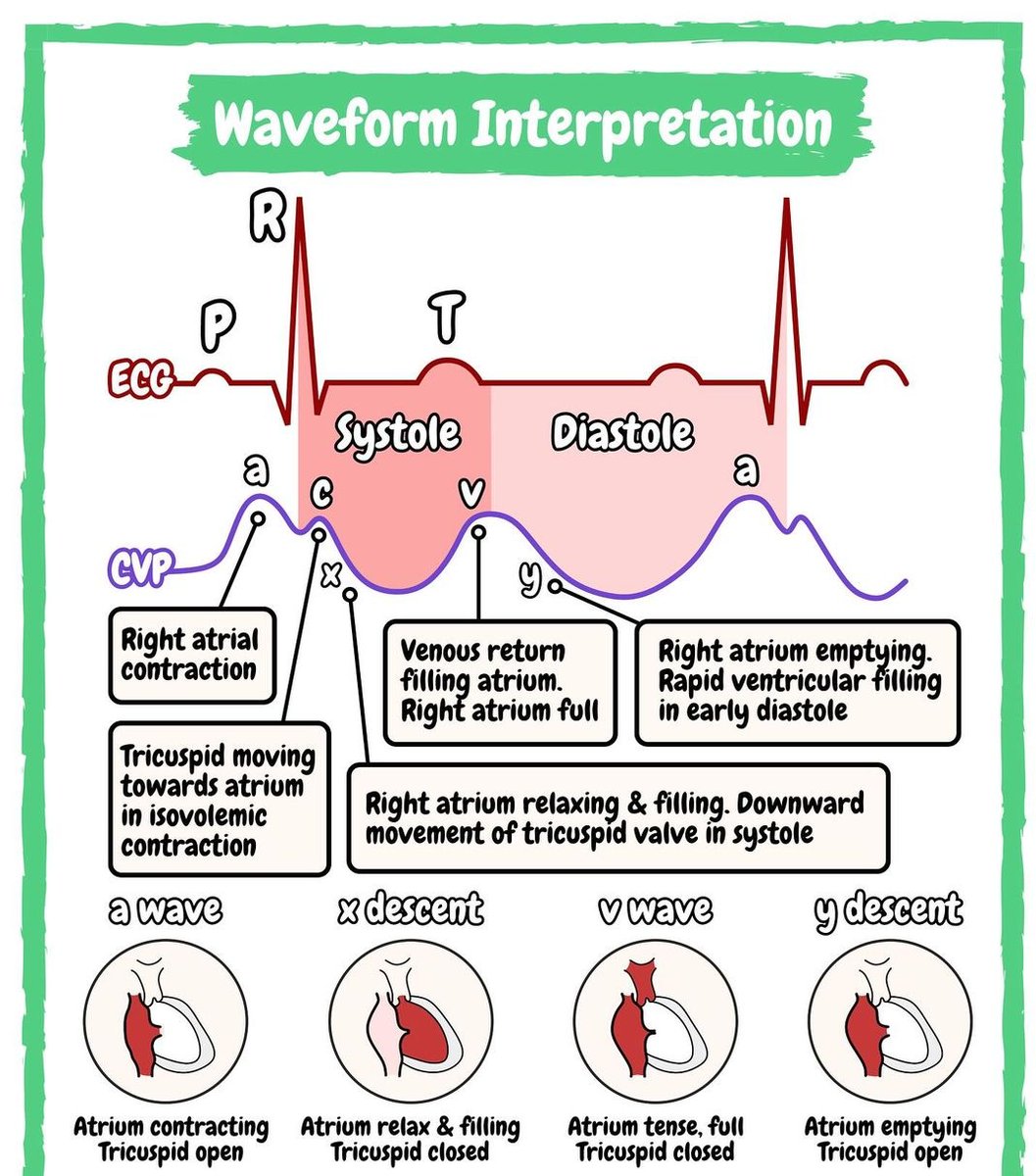 🔴 #ECG and #CVP waveform in a cardiac cycle.⤵️ 🔹 #Cardiology #FOAMed # ...