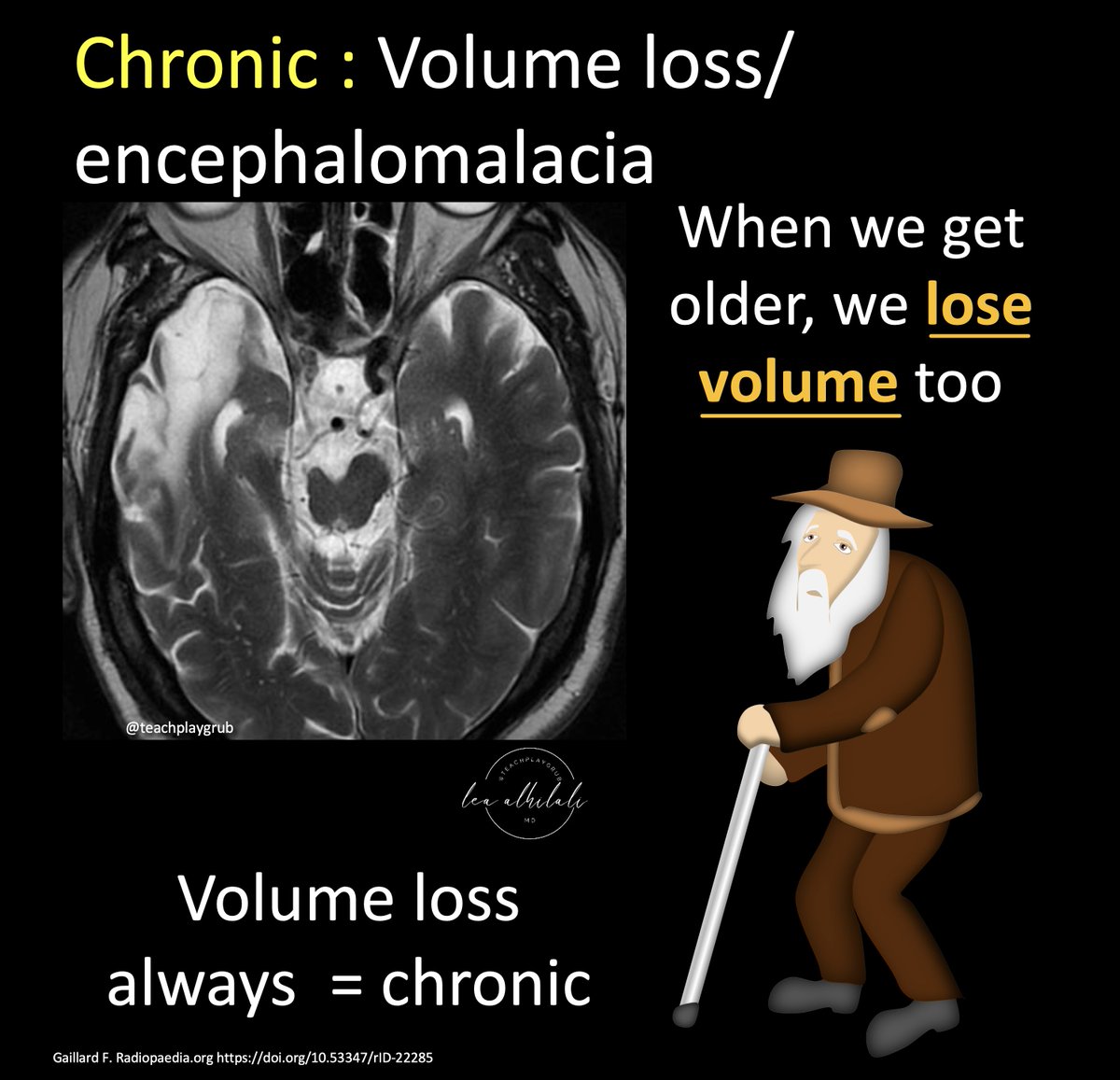 1/Time is brain! But what time is it? If you don’t know the time of ...