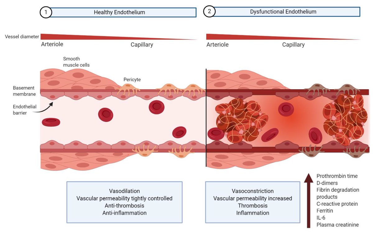 A new study shows that SARS-CoV-2 infection causes vascular dysfunction ...