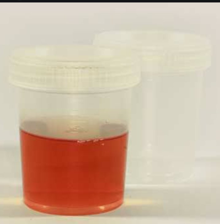 What your urine colour says about your health and what you should do 1 ...