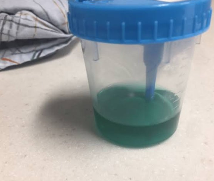 What your urine colour says about your health and what you should do 1 ...