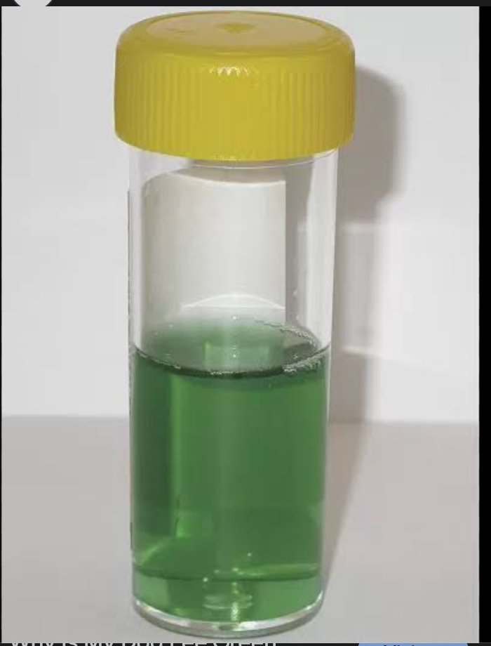 What your urine colour says about your health and what you should do 1 ...