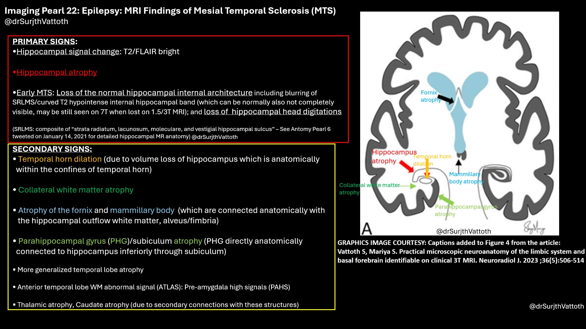 Mesial Temporal Lobe Anatomy