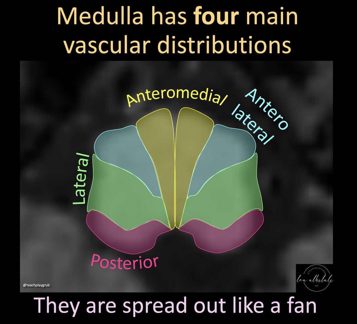 1/The medulla is anything but DULL! Does seeing an infarct in the ...