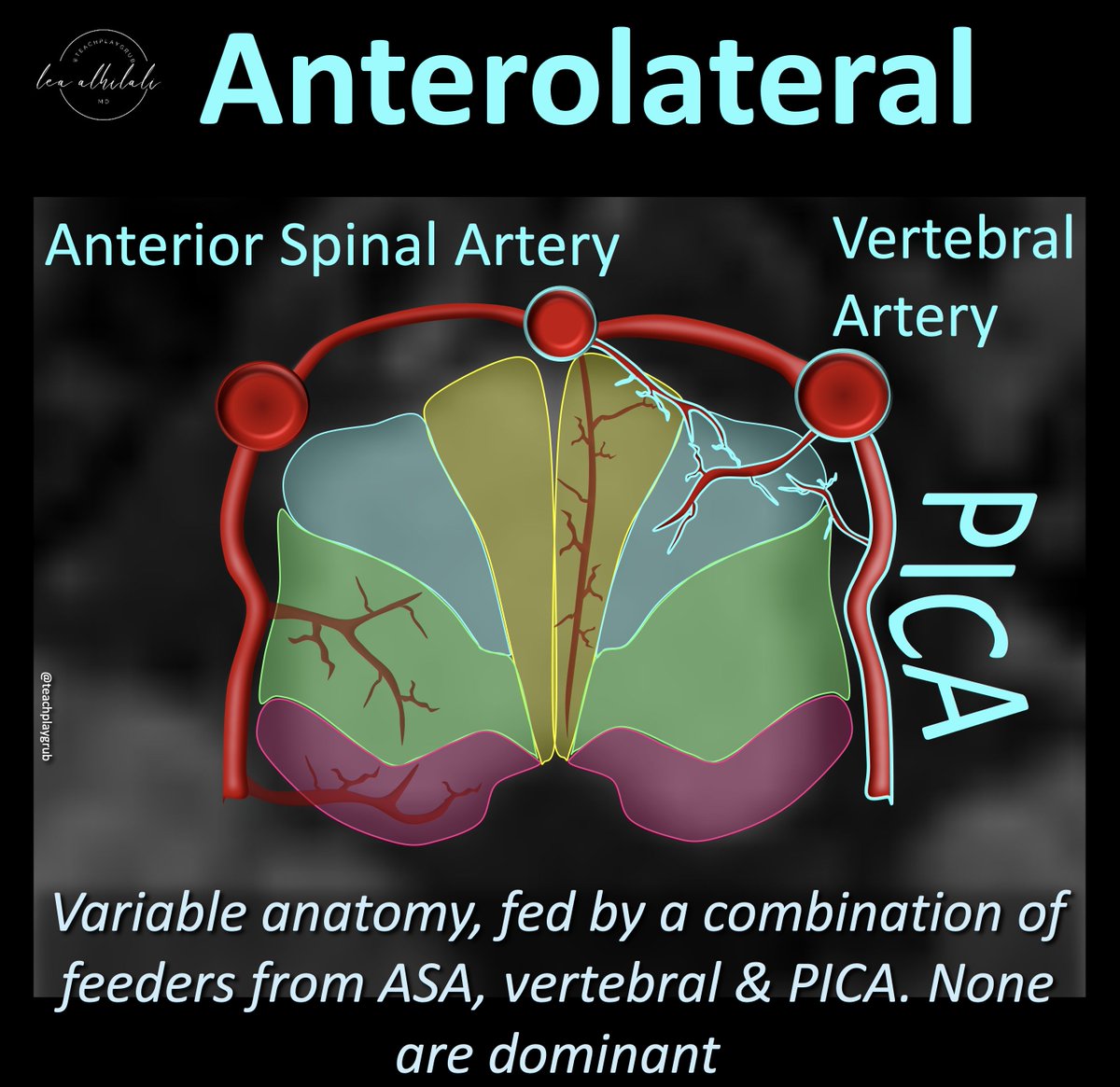 1/The medulla is anything but DULL! Does seeing an infarct in the ...