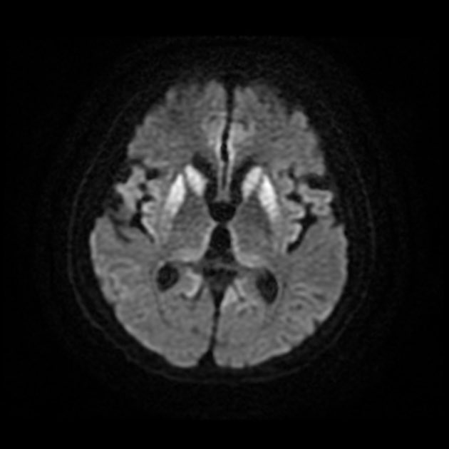 👩🏽‍💻𝘀𝗶𝗴𝗻𝗼𝘀 𝘤𝘭𝘢́𝘴𝘪𝘤𝘰𝘴 de 𝗻𝗲𝘂𝗿𝗼𝗶𝗺𝗮𝗴𝗲𝗻🩻 que ayudan en el diagnóstico⚖ ...