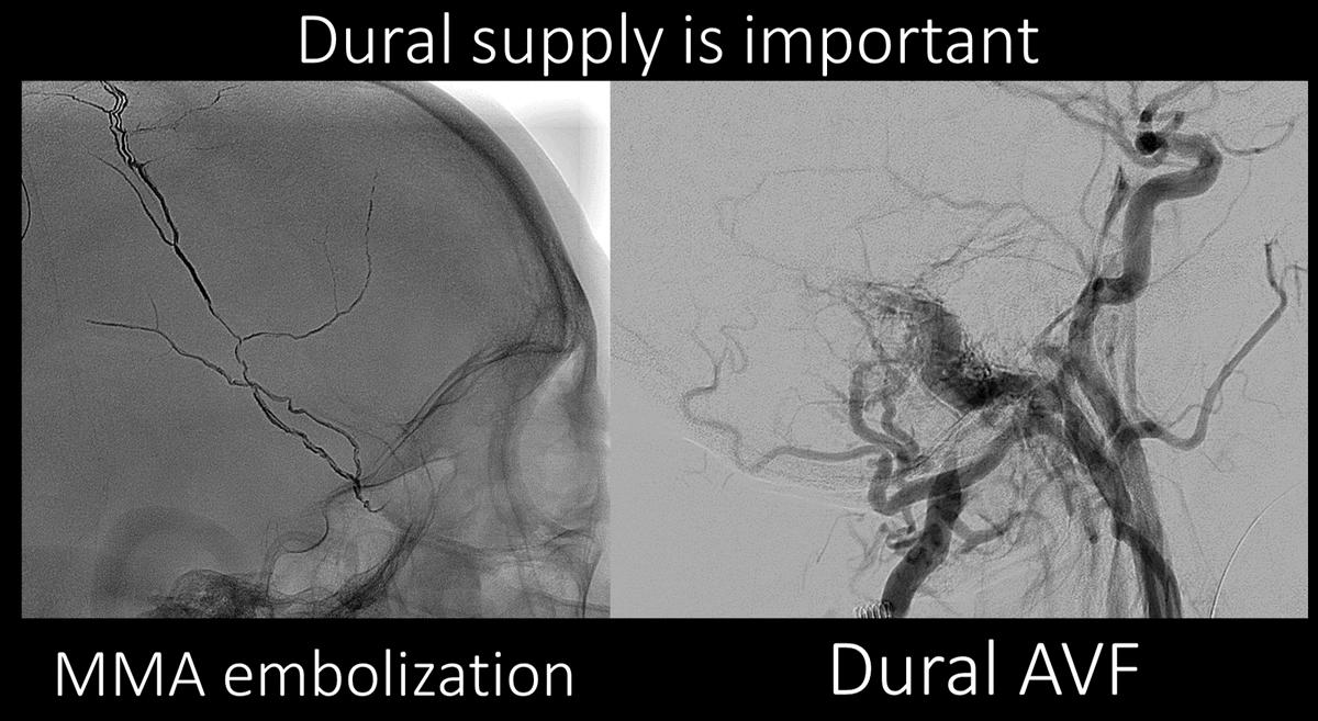 1/Ready for a throw down? MMA fights get a lot of attention, but MMA ...