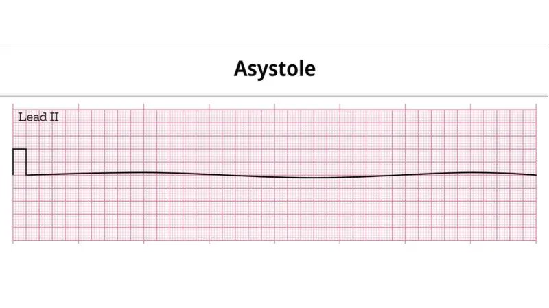 ICU Resuscitation Thoughts: Every 2 y this time of the year I have to ...
