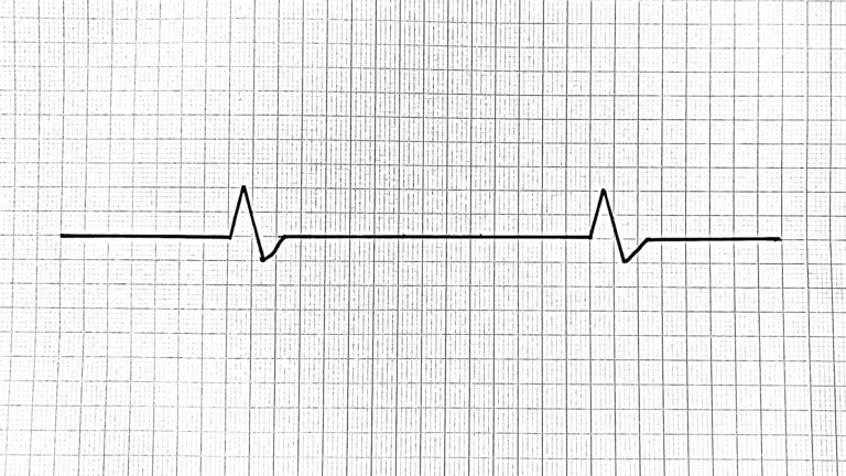 ICU Resuscitation Thoughts: Every 2 y this time of the year I have to ...