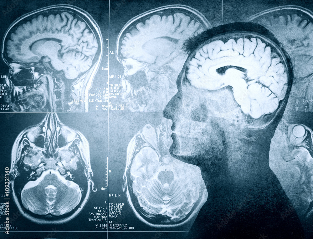 The most misunderstood & undervalued topic in health: Circadian Rhythms ...