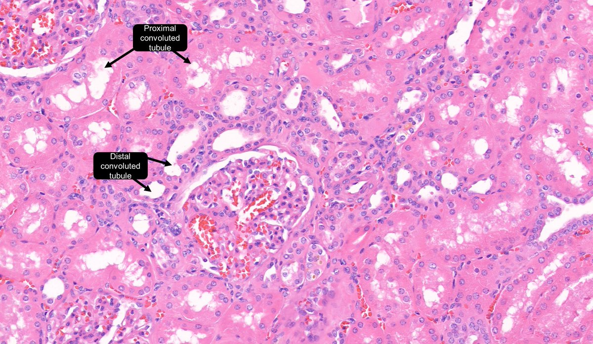 Distal Convoluted Tubule Slide