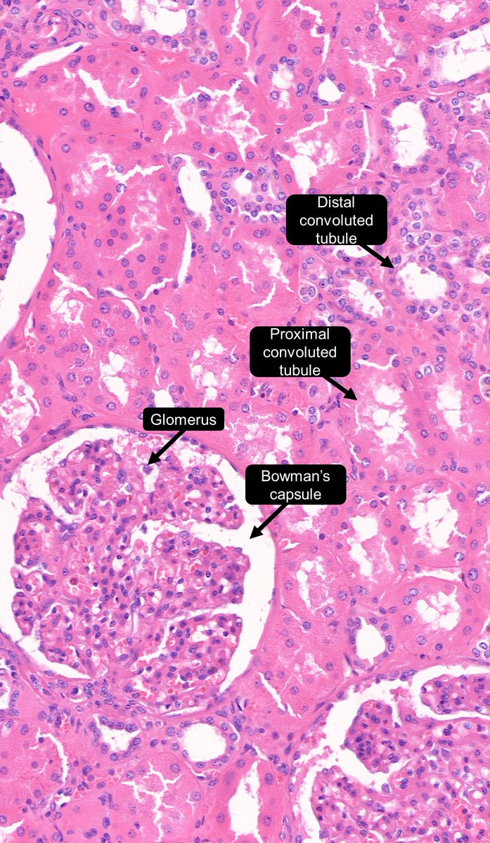 Distal Convoluted Tubule Slide
