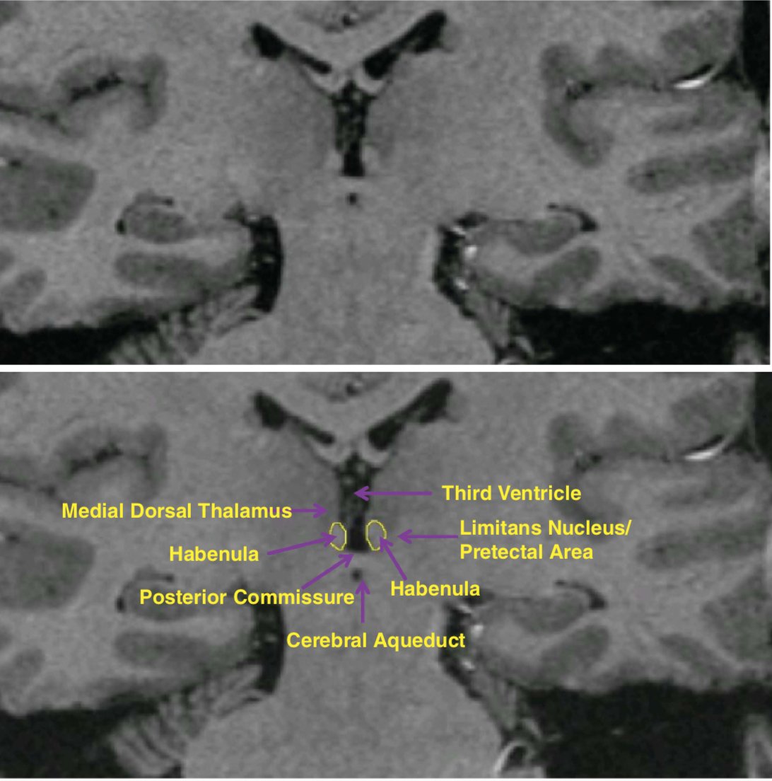 Everyone knows about reward systems in the brain. Today we meet the ...