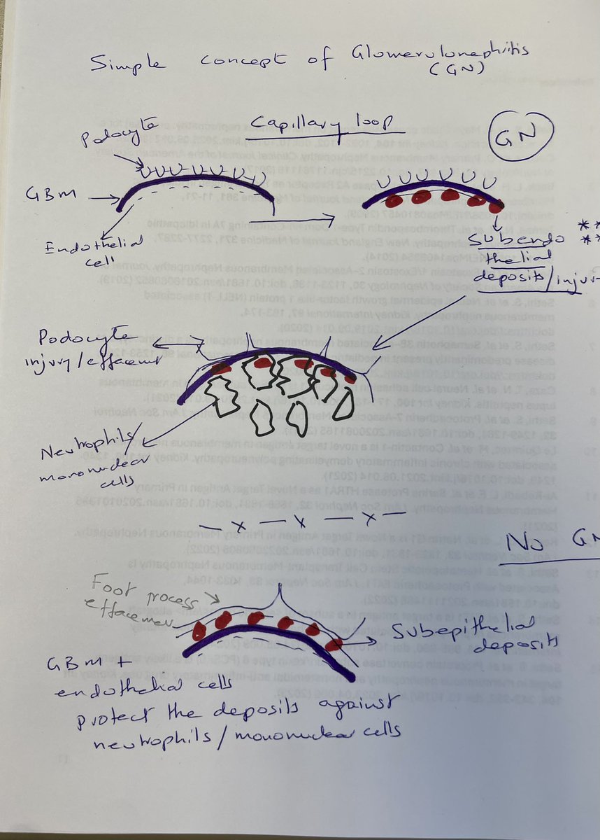 Simple concept of GN. It’s all about location! 1. Subendothelial ...