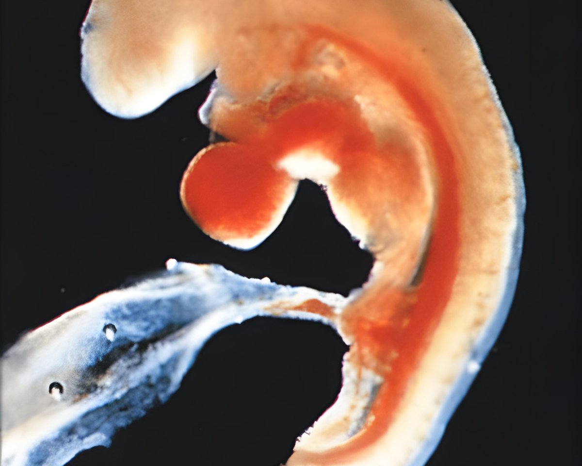 [🧵 Thread] The Qur’ān, Bible, and Science on Embryology Comparative ...