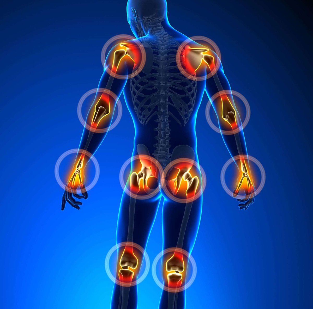 Your bad posture is destroying your health daily… The results? Chronic ...