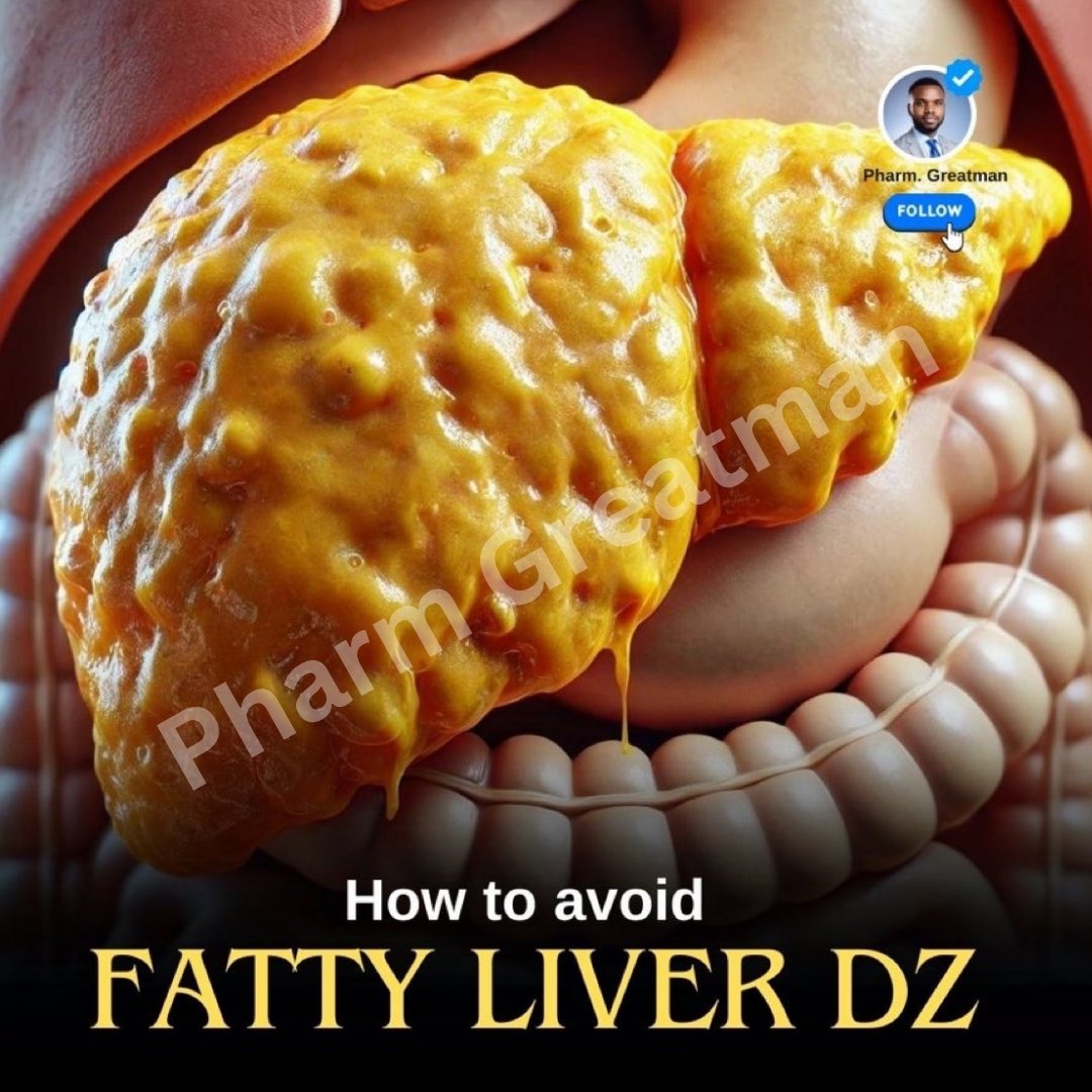 HOW TO AVOID FATTY LIVER DISEASE One cause of always feeling tired or having unexplained weight ...