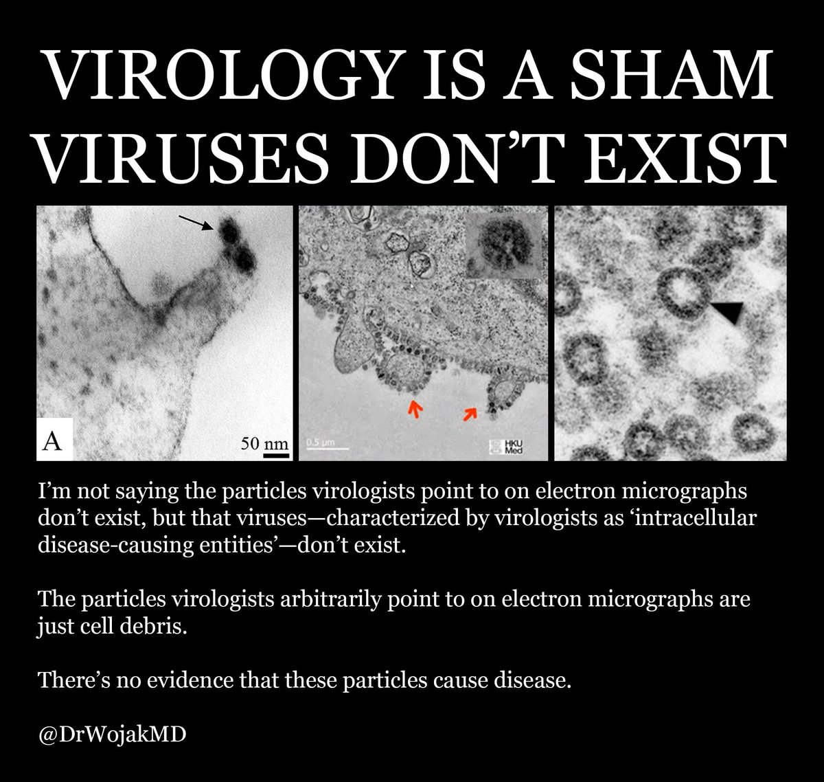 (1/28) 🚨⚠️ Virology is a Sham — Explained for Every Attention Span I’ve ...