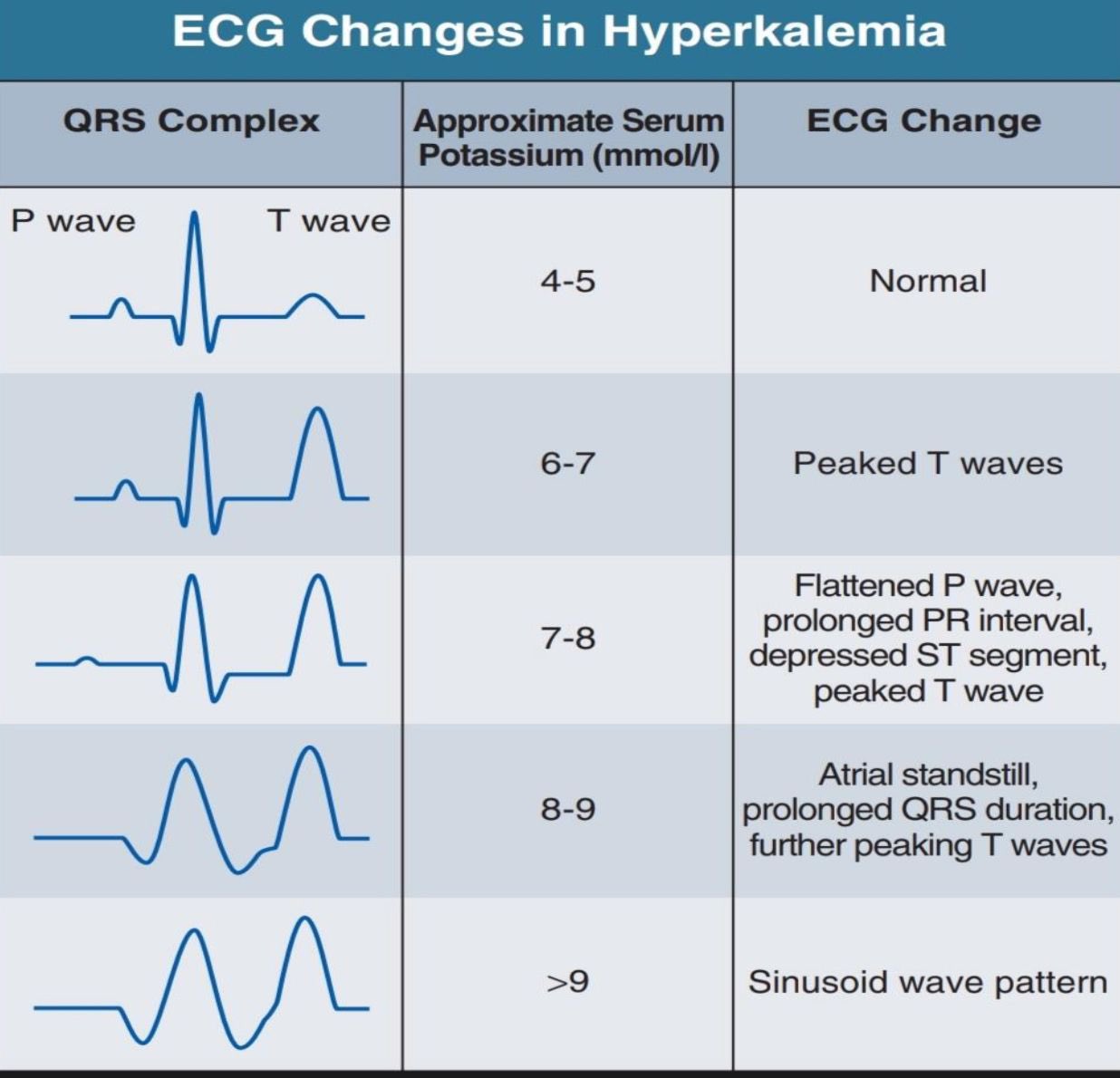 Ecg Changes In Hyperkalemia Epomedicine Hypokalemia And Hyperkalemia