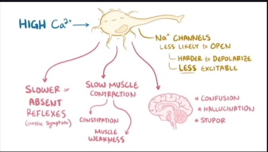 👉🏻 🧵This is a thread about Hypercalcemia in critical care. 🚨 Rare but ...