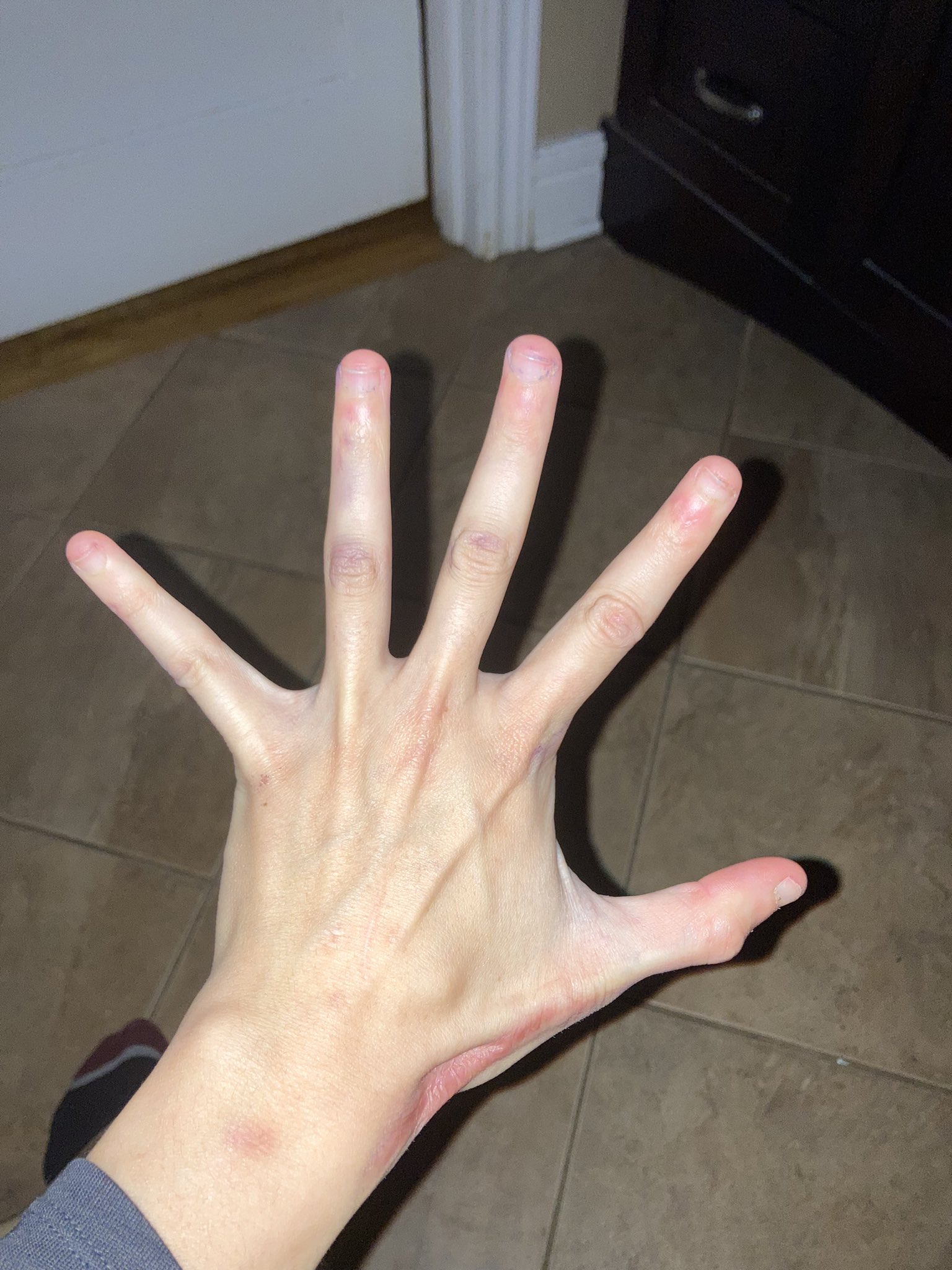 People With Long Fingers