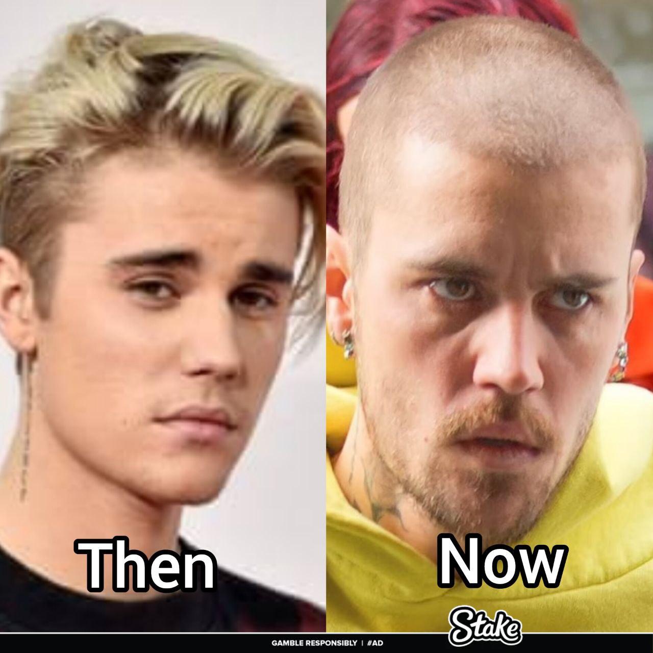 Justin Bieber Then And Now