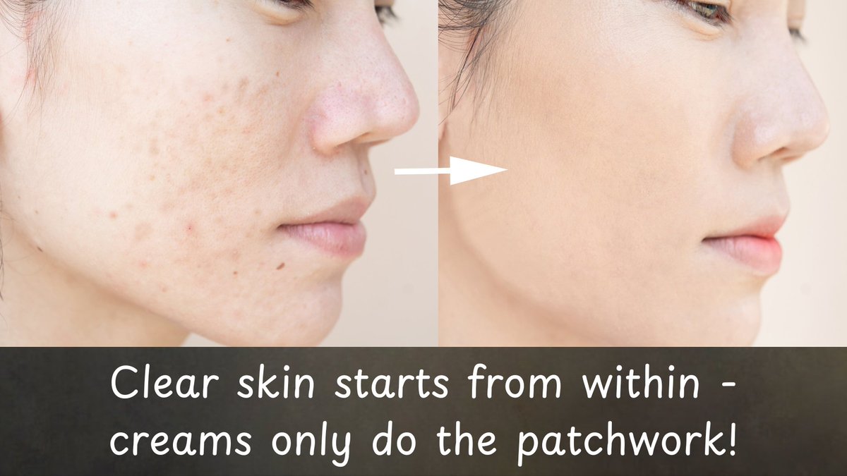 Thread by @dr_sumit_sharma on Thread Reader App – Thread Reader App