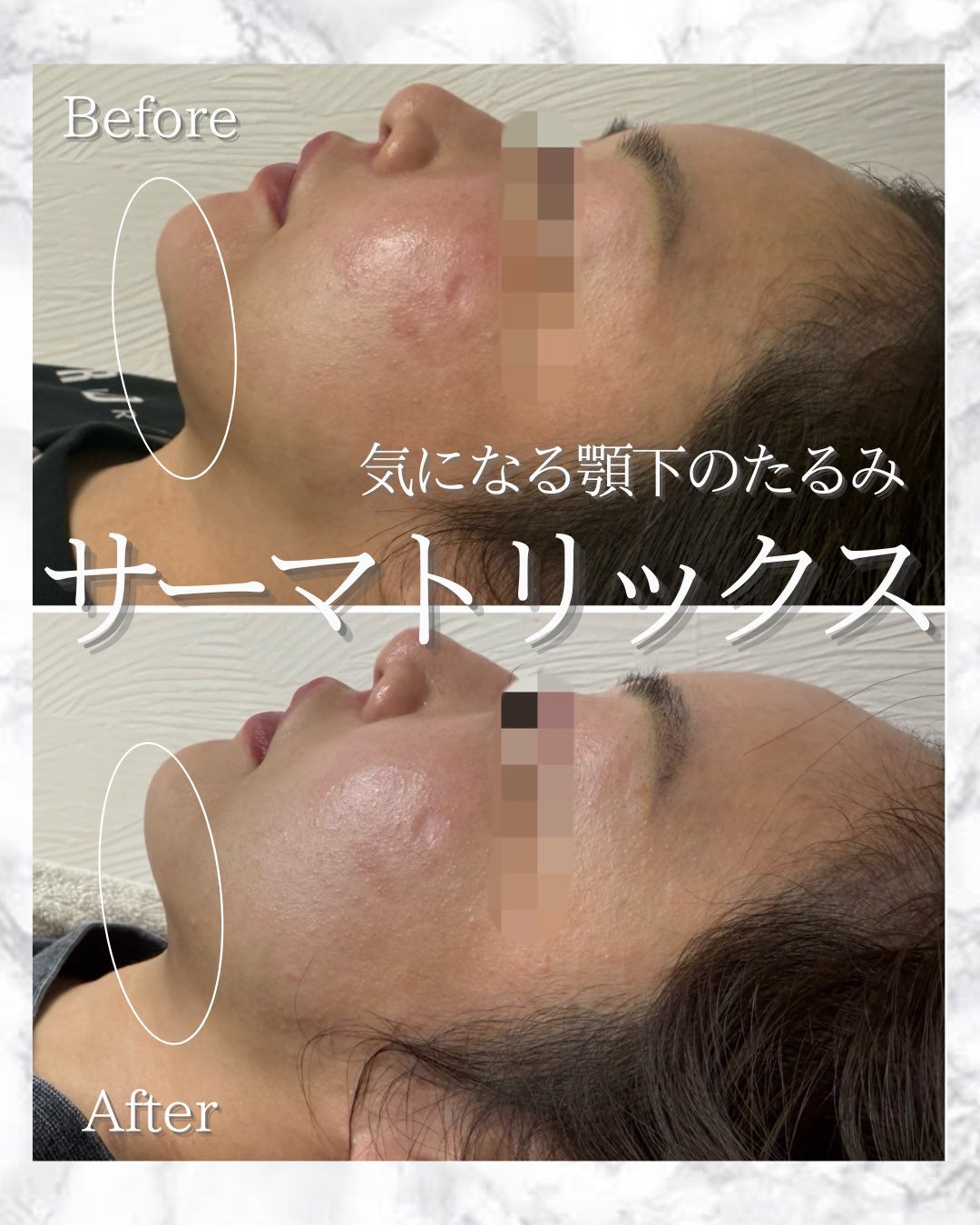 mulea新宿【サーマトリックス/アクアダーマ/ララピール/ハーブ mulea新宿【サーマトリックス/アクアダーマ/ララピール/ハーブ