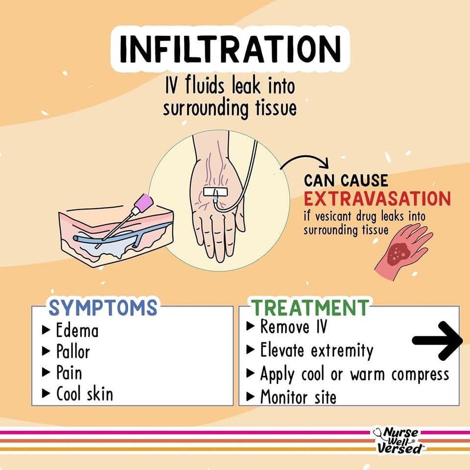 Iv Complications Phlebitis