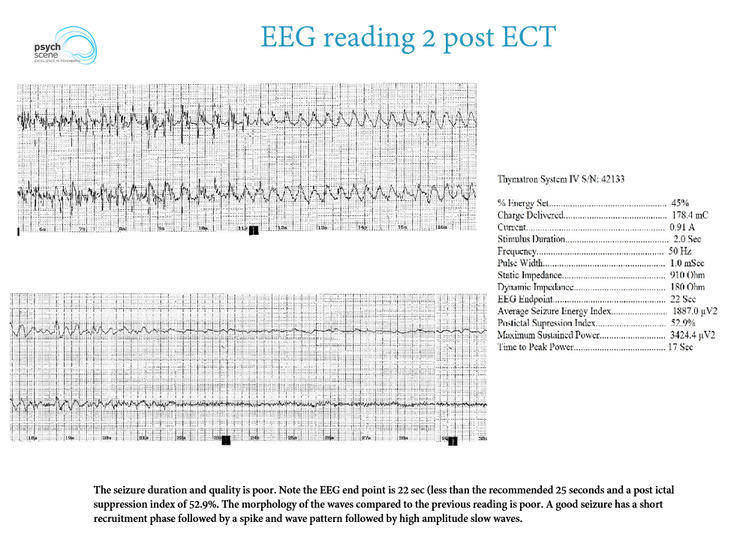 Thread by @psycheureka on Thread Reader App – Thread Reader App