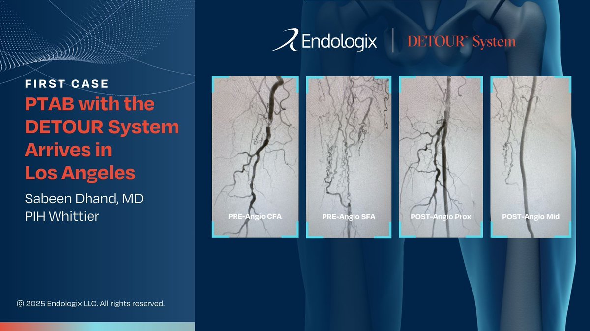 Endologix Logo Michael Ross Endologix